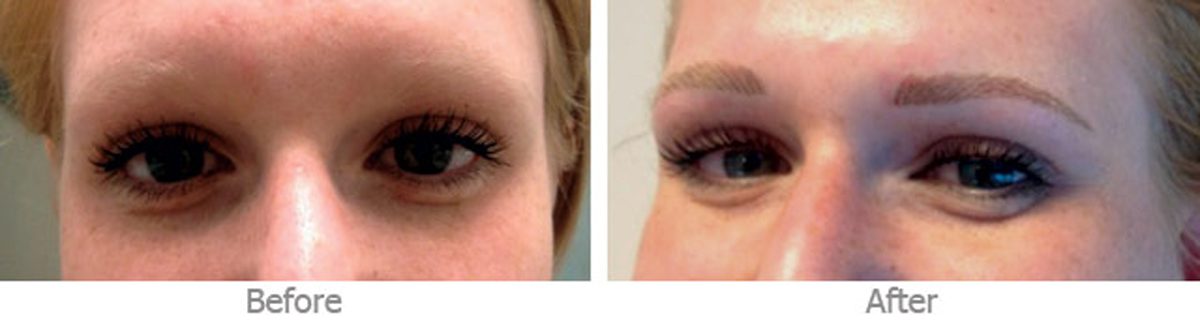 Brows | Look Natural Micropigmentation Clinic