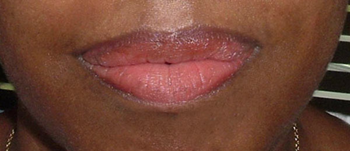 Semi-Permanent Lip Color | Look Natural Micropigmentation Clinic